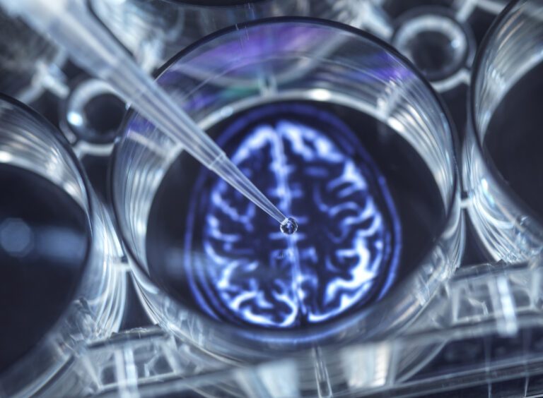 Resources - Smart Reactors