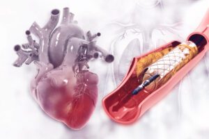 Resources - Smart Reactors