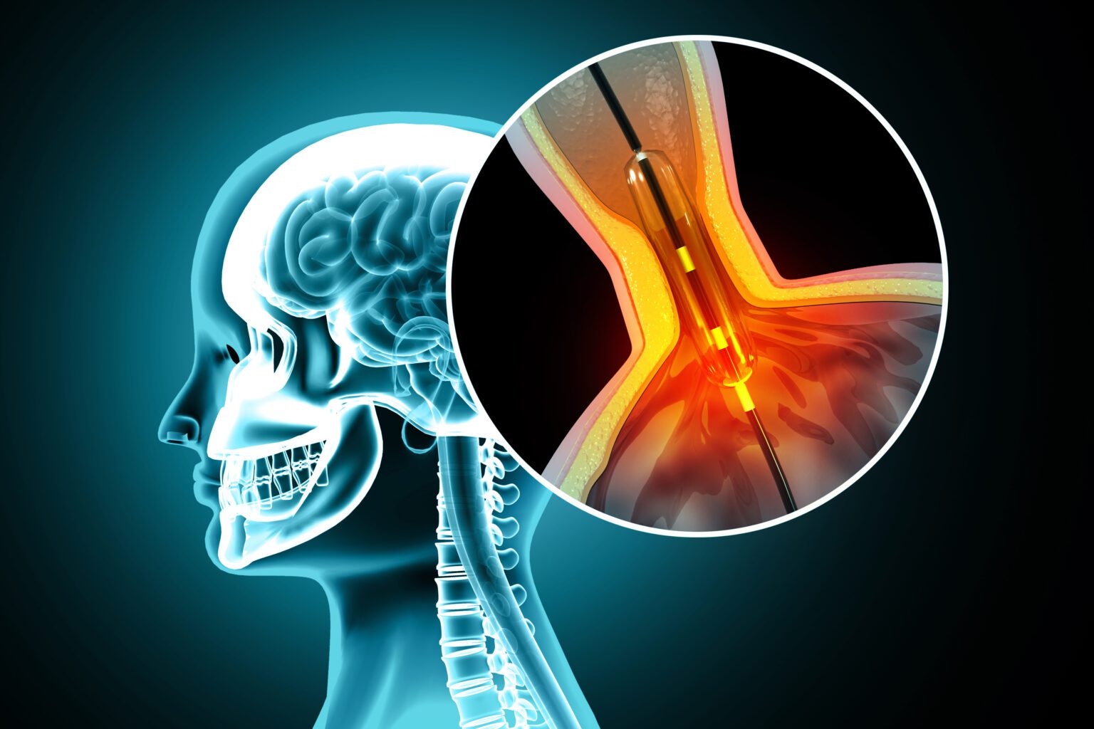 Resources - Smart Reactors